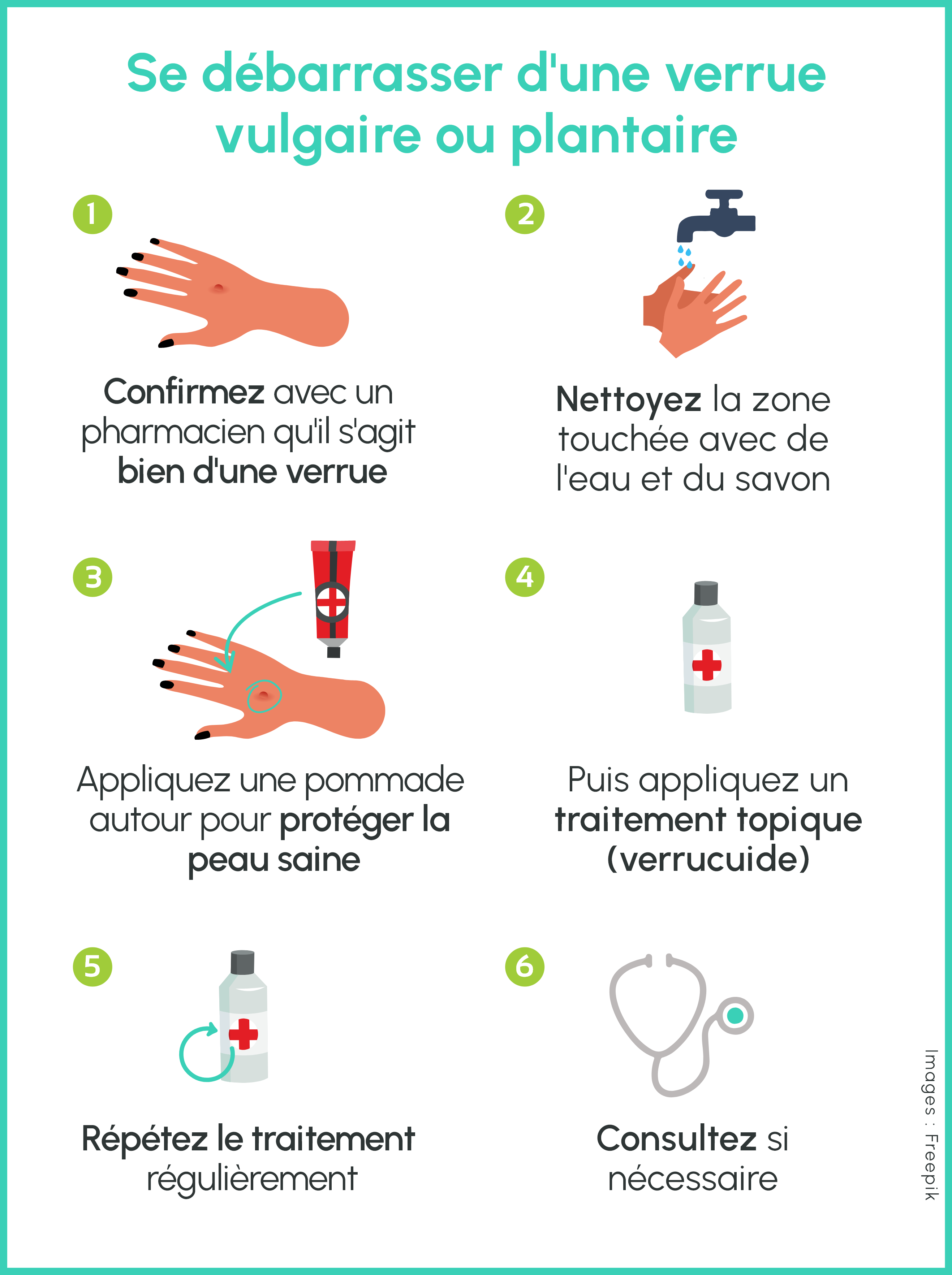 Pharmacie Sainte Croix - Se débarrasser d'une verrue vulgaire ou plantaire